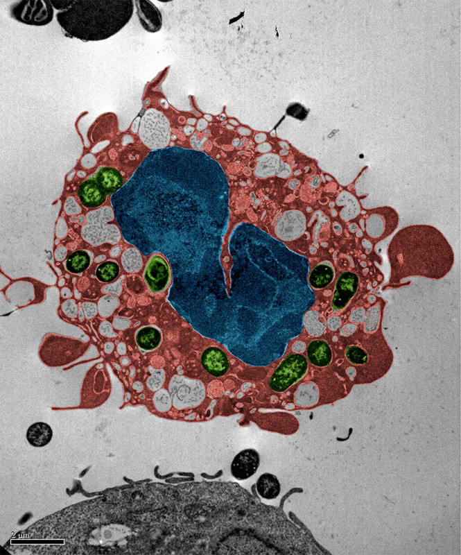 The Black Death bacteria continues to kill