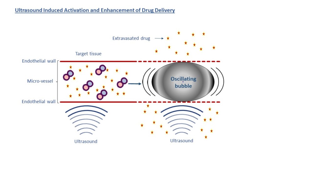 Bubbles and ultrasound destroy tumours in lab animals