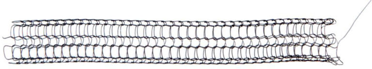 Removable airway stent could revolutionize surgery
